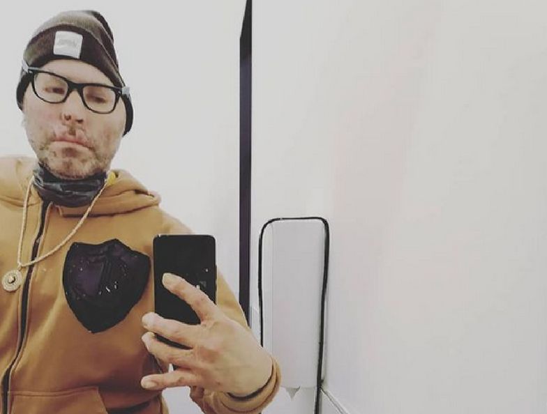 Raper stracił połowę czaszki. "Popełniłem ogromny błąd" - o2 - Serce ...