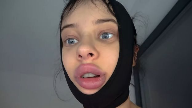 Fagata zabrała głos. Wspomniała bolesne operacje plastyczne - Pudelek