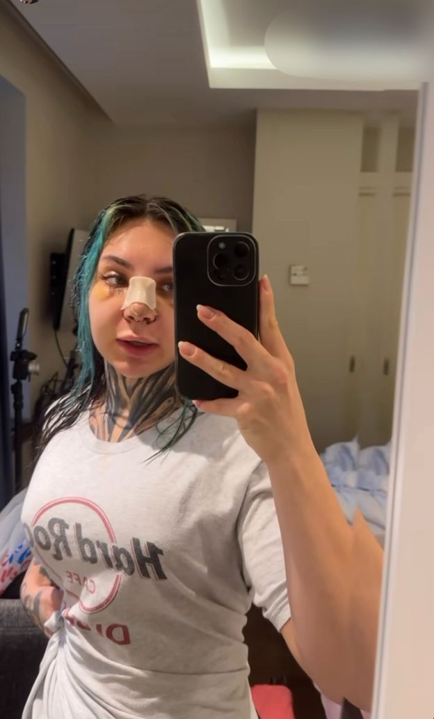 Sheeya zoperowała sobie w Turcji nos i powiększyła piersi! - Pudelek