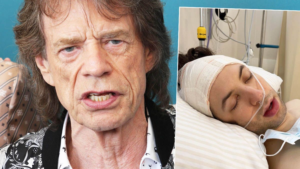 21-letni syn Micka Jaggera przeszedł operację plastyczną. Pokazał ...