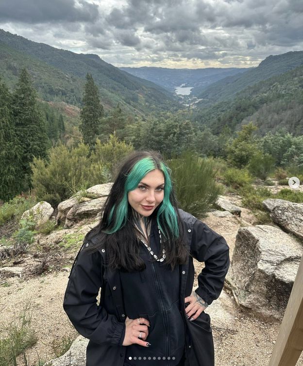 Sheeya zoperowała sobie w Turcji nos i powiększyła piersi! - Pudelek