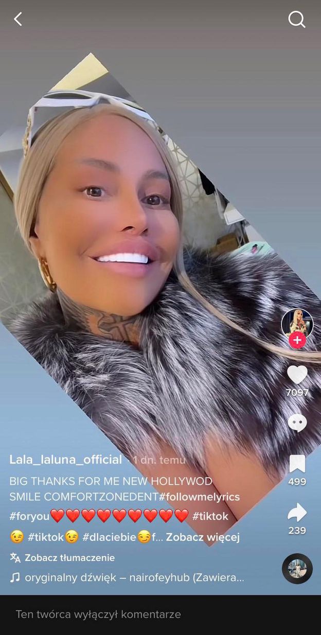 U Laluny Unique z "Królowych życia": BEZ ZMIAN: Poleciała do Turcji po... NOWE ZĘBY za 20 ...