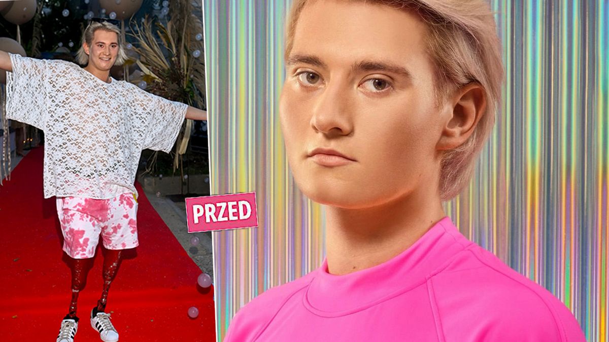 Pojawił się w "Top Model" i wzbudził sensację nieidealnym ciałem. Jak ...