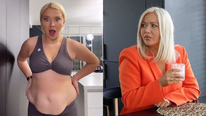 Przeszła plastykę brzucha. Pokazała skórę po 4 miesiącach - Pudelek