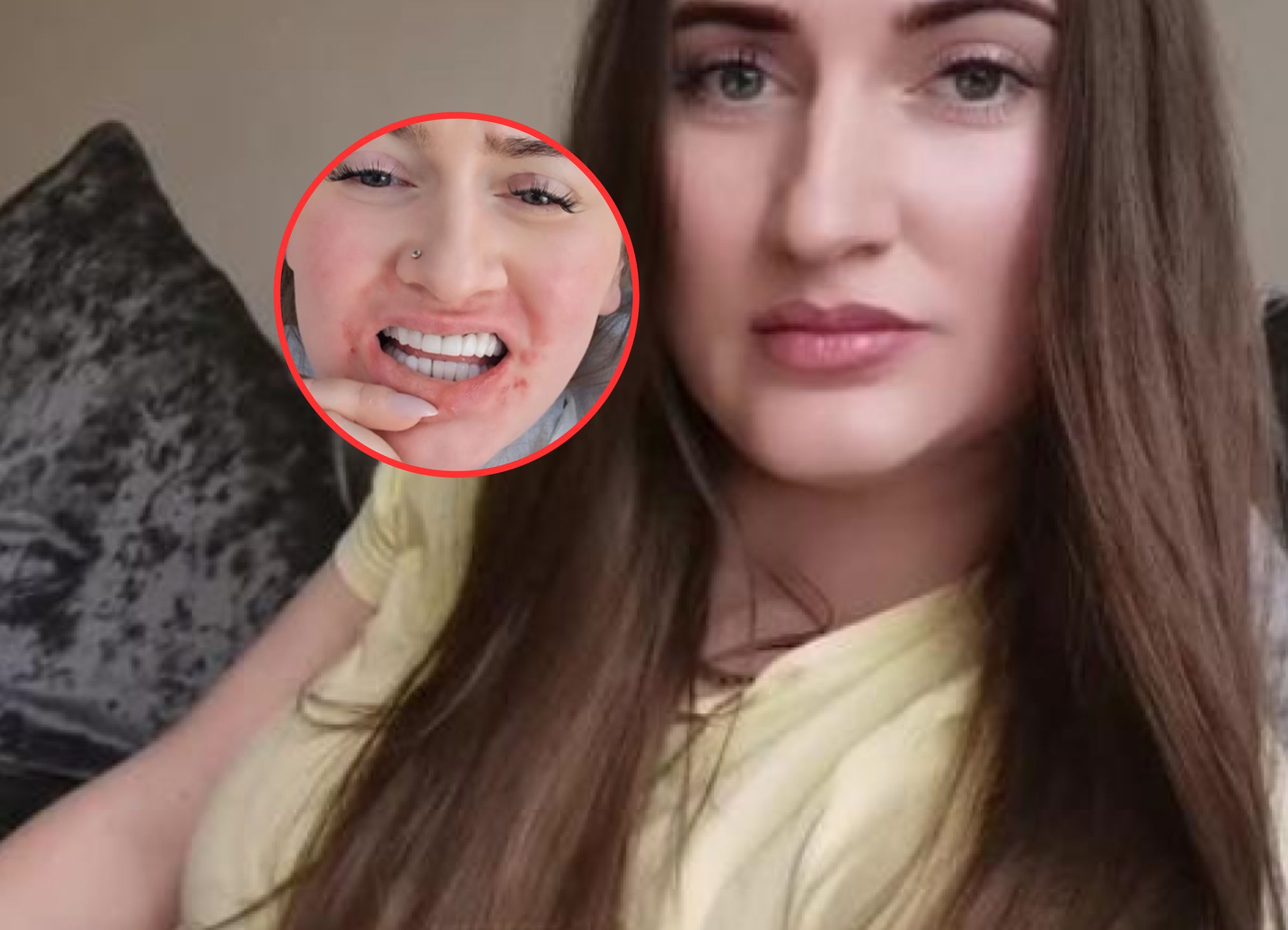 Wydała 30 tys. zł na "tureckie zęby". Internauci ją wyśmiali