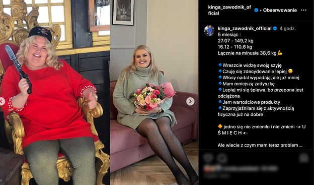 Kinga Zawodnik zdradza, ile schudła. Przeszła operację zmniejszenia żołądka - Pudelek