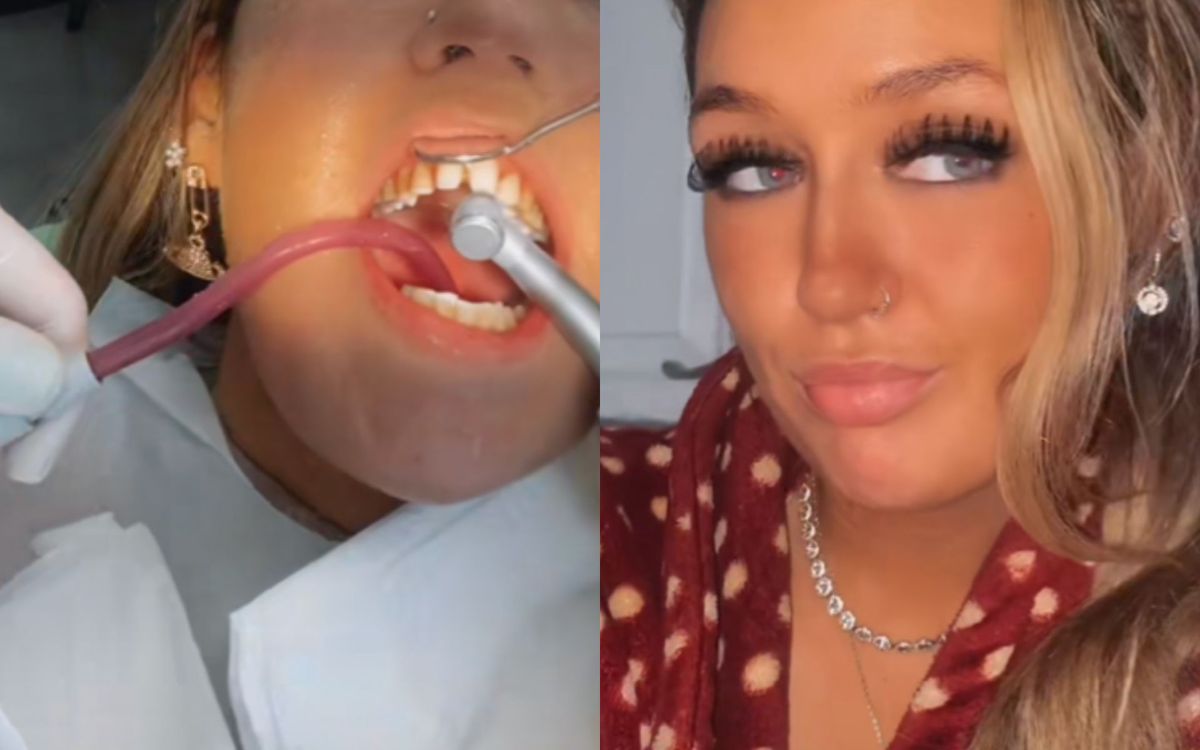 Zaufała tureckim dentystom. Z takimi zębami wróciła do domu - WP Kobieta