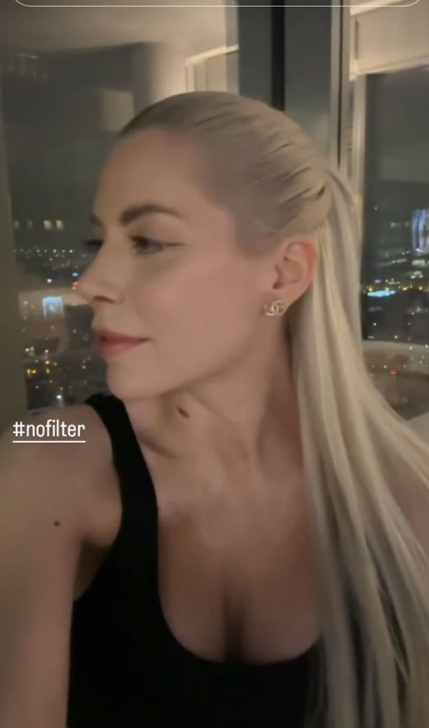 Julia von Stein pochwaliła się nowym nosem. Internautka: "Nie widać różnicy" - Pudelek