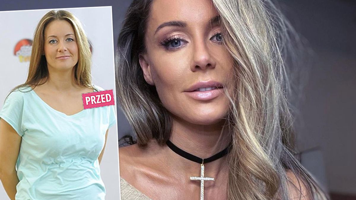 Specjalistka wylicza wszystkie zabiegi, którym poddała się Rozenek. Oto sekrety nieskazitelnego ...