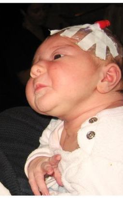 Dorotka ma 8 lat i cierpi na zespół Retta. To bardzo rzadka choroba