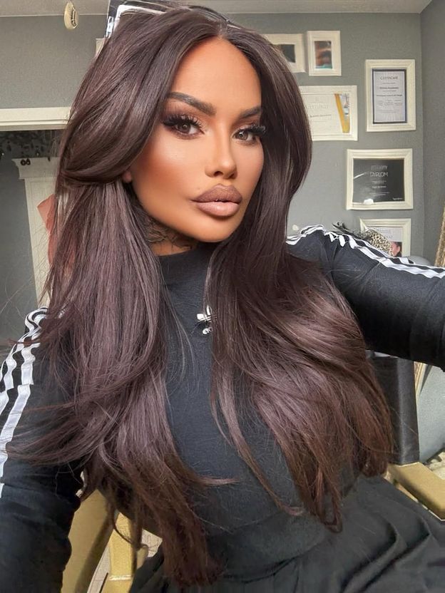 Laluna pokazała zdjęcie z młodości. Tak wyglądała przed operacjami ...