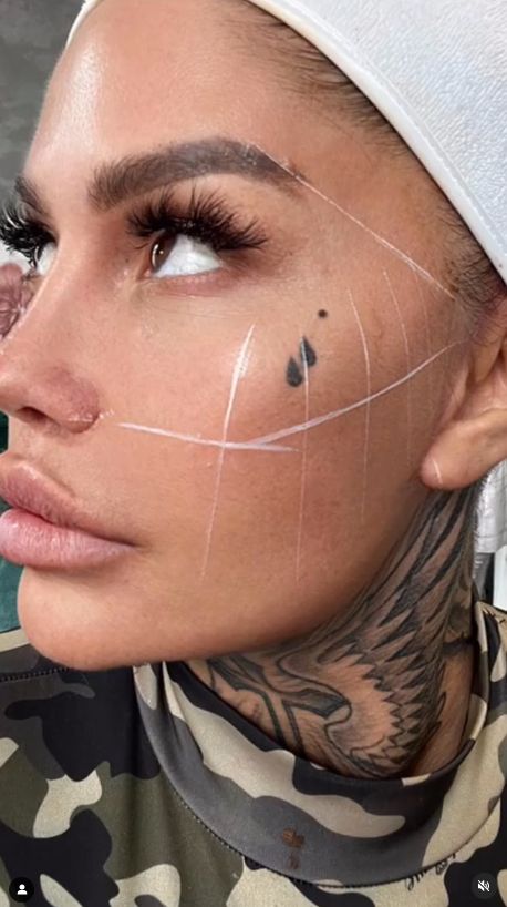 Kolejny raz poddała się zabiegowi. Zmieniła rysy twarzy. Pokazała ...