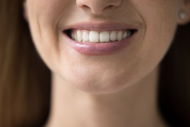 Dr Smile z zarzutami UOKiK. "Wywieranie presji i manipulowanie" - Money.pl