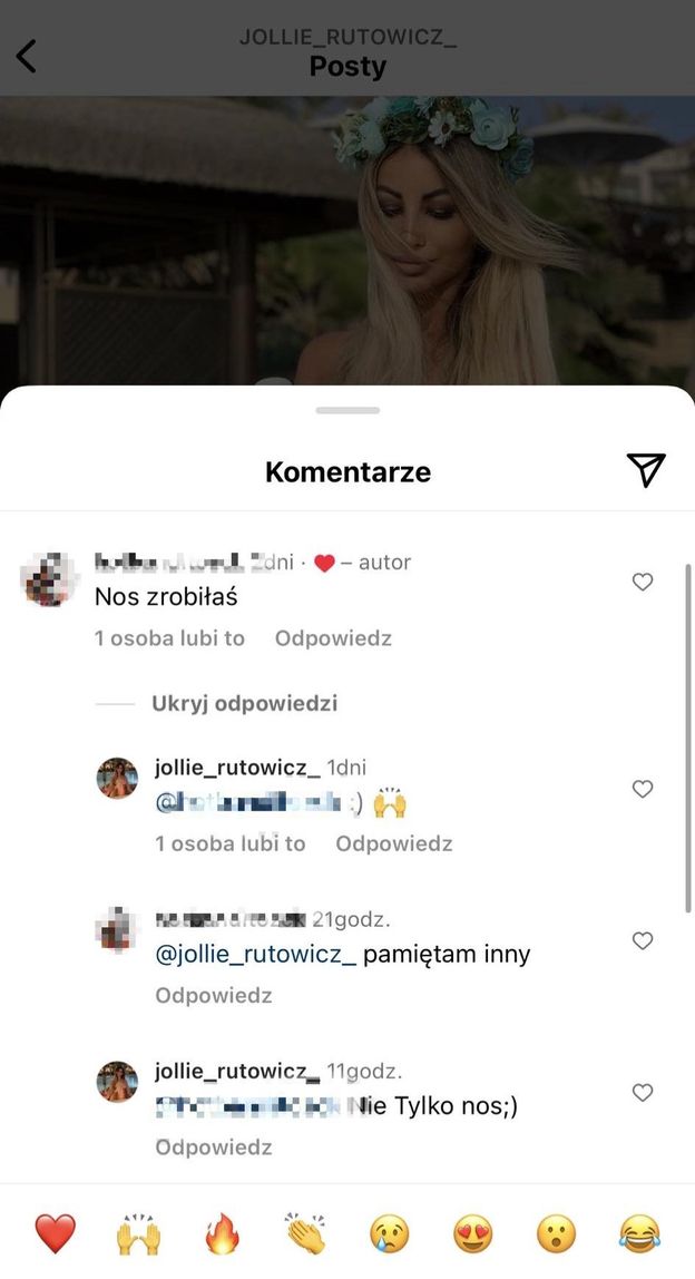 Poszła pod nóż? Wymowne słowa Rutowicz. Jest nie do poznania - Pudelek