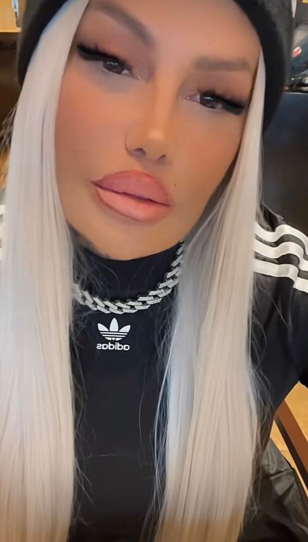 Laluna Unique robi sobie nowe zęby. Zdradziła koszt zabiegu w Turcji ...