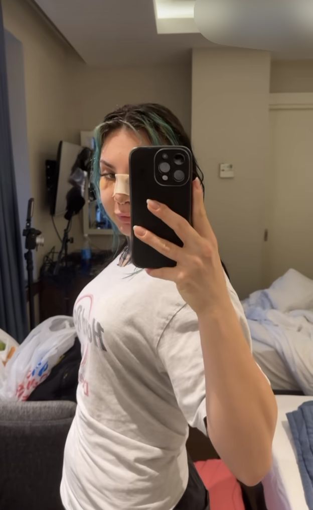 Sheeya zoperowała sobie w Turcji nos i powiększyła piersi! - Pudelek