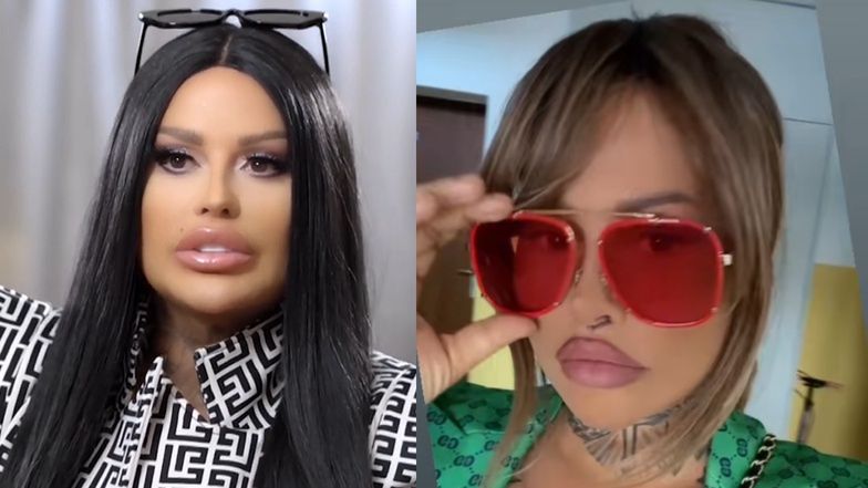 Laluna Unique prezentuje NOWĄ TWARZ bez opatrunków po kolejnej operacji ...